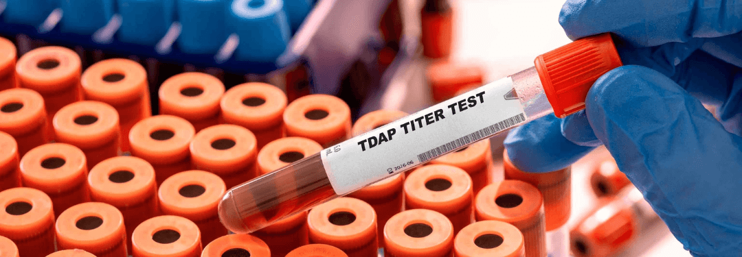 Importance of Employee Titers Test | Mobile Health