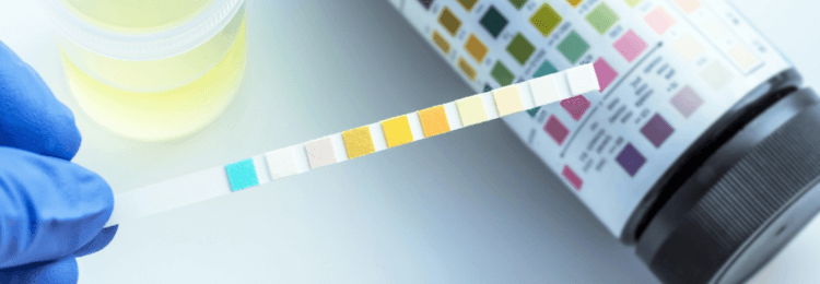 The Importance of Drug & Alcohol Testing in the Workplace